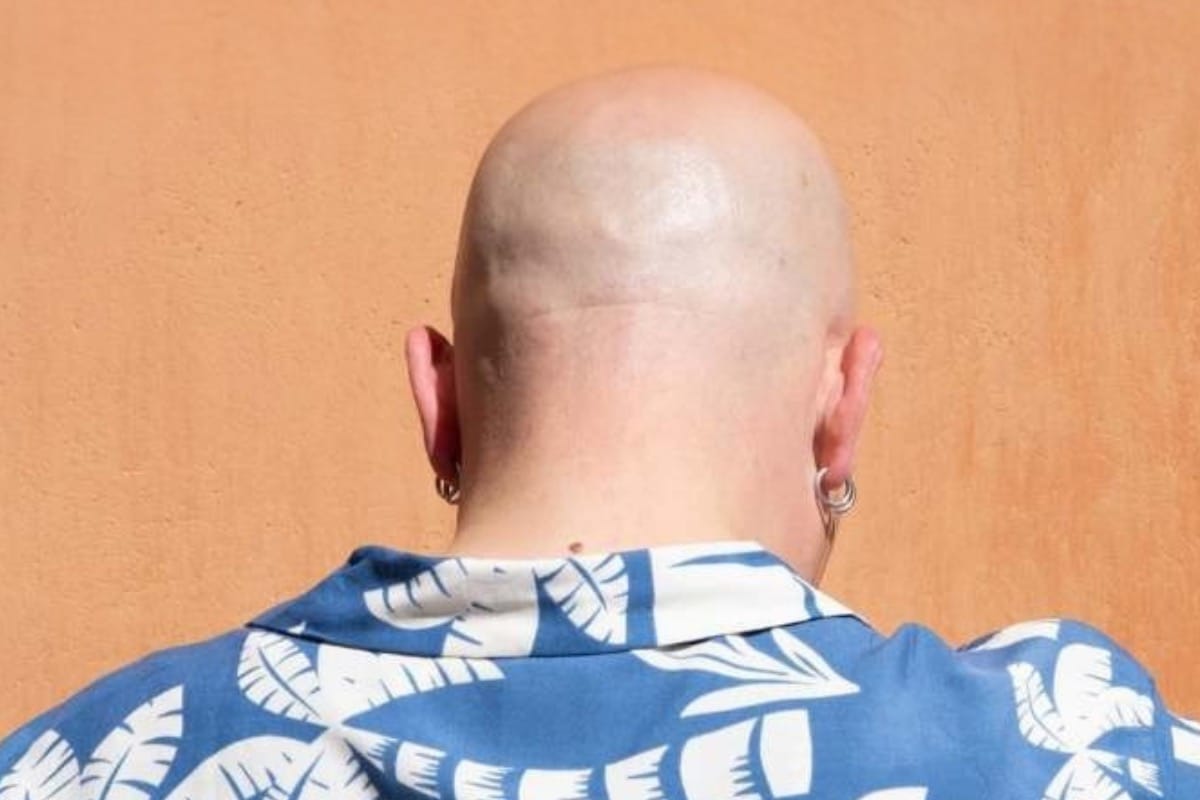 Hoe verzorg je een kaal hoofd?